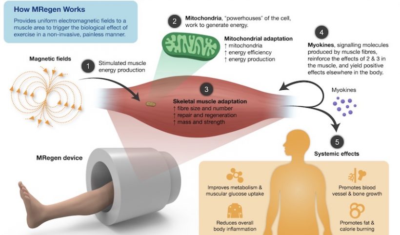 New Medical Equipment Uses Magnetic Field To Accelerate Muscle Recovery ...