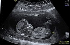 9 Best Examples Of Longitudinal Waves In Everyday Life - RankRed